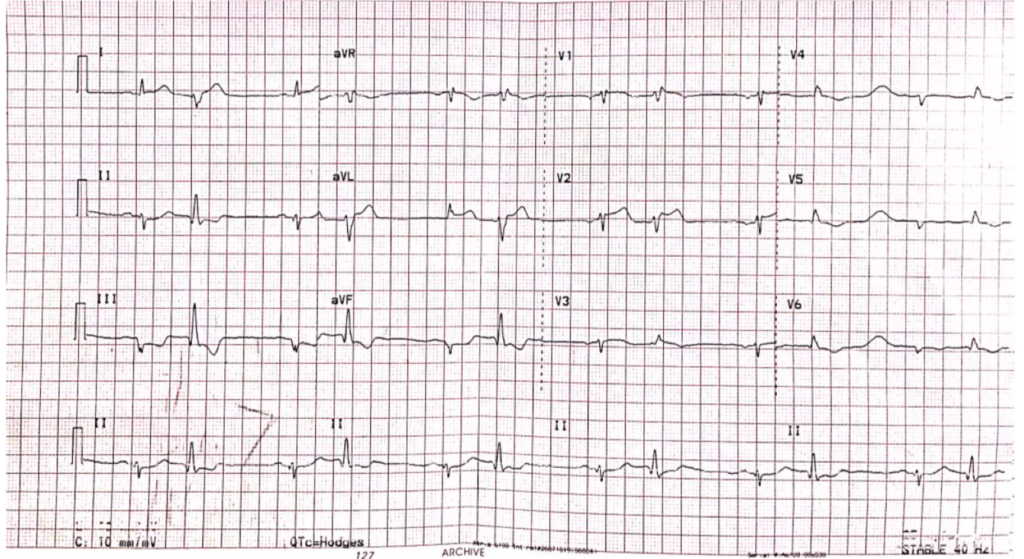 Sociedad Panameña de Cardiología | Casos Clínicos